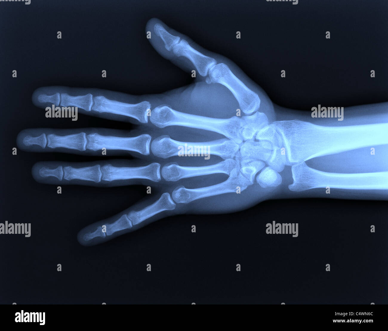 X-ray of hand Stock Photo - Alamy