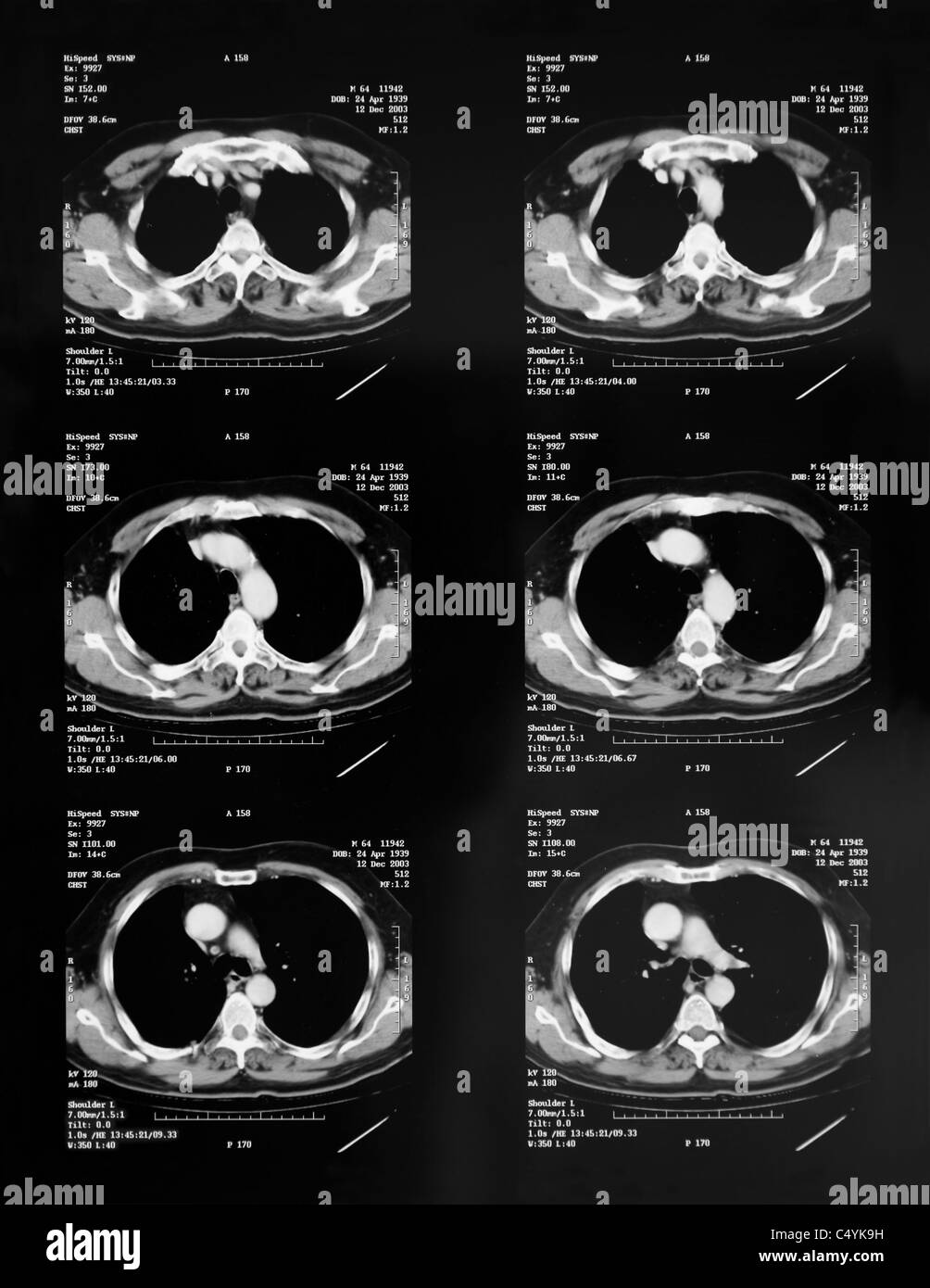 Multiply the magnetic resonance images of the human body Stock Photo ...