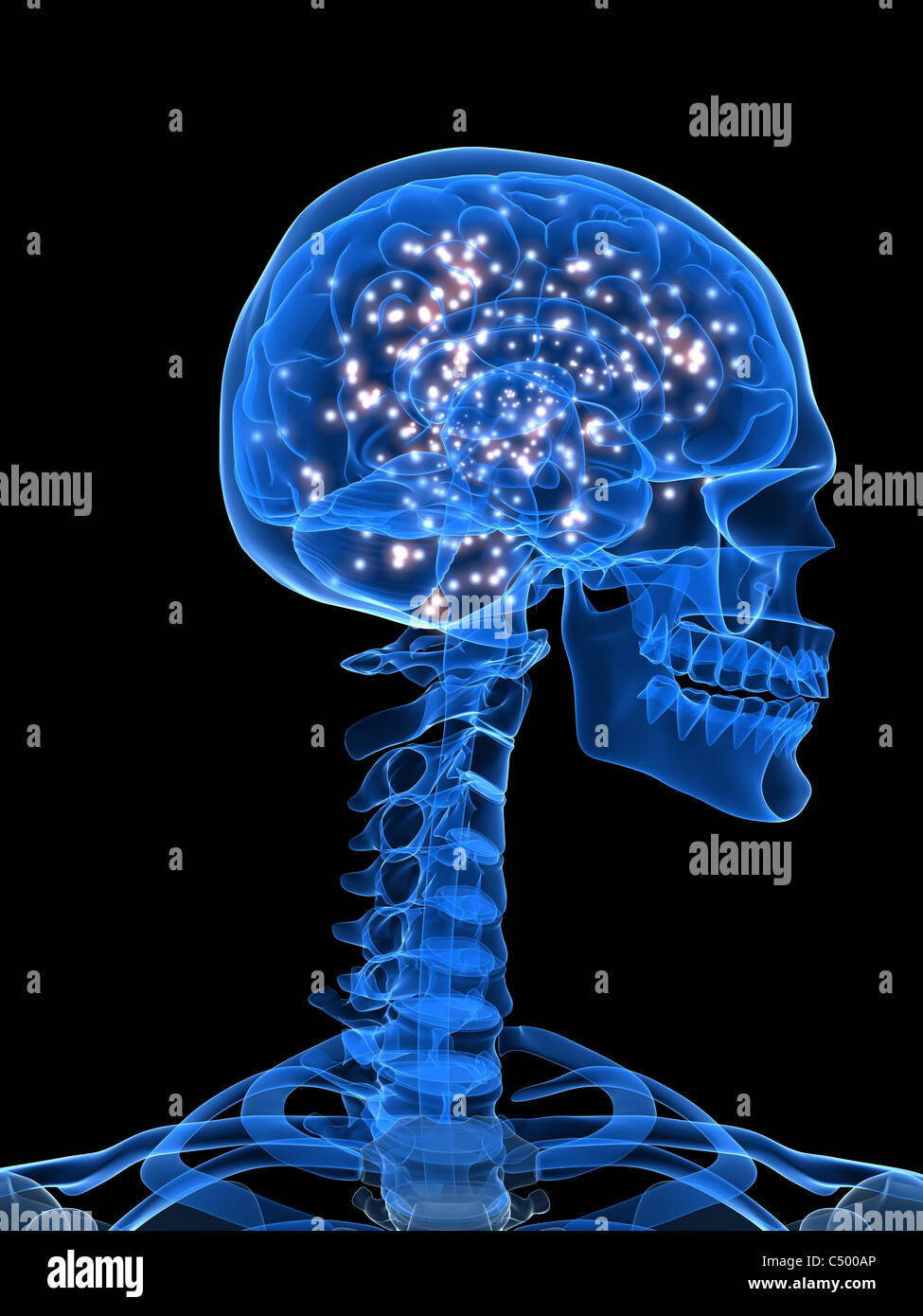 Brain scan hi-res stock photography and images - Alamy