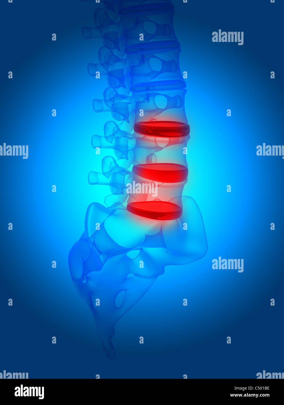 Spinal Disc Stock Photos & Spinal Disc Stock Images - Alamy