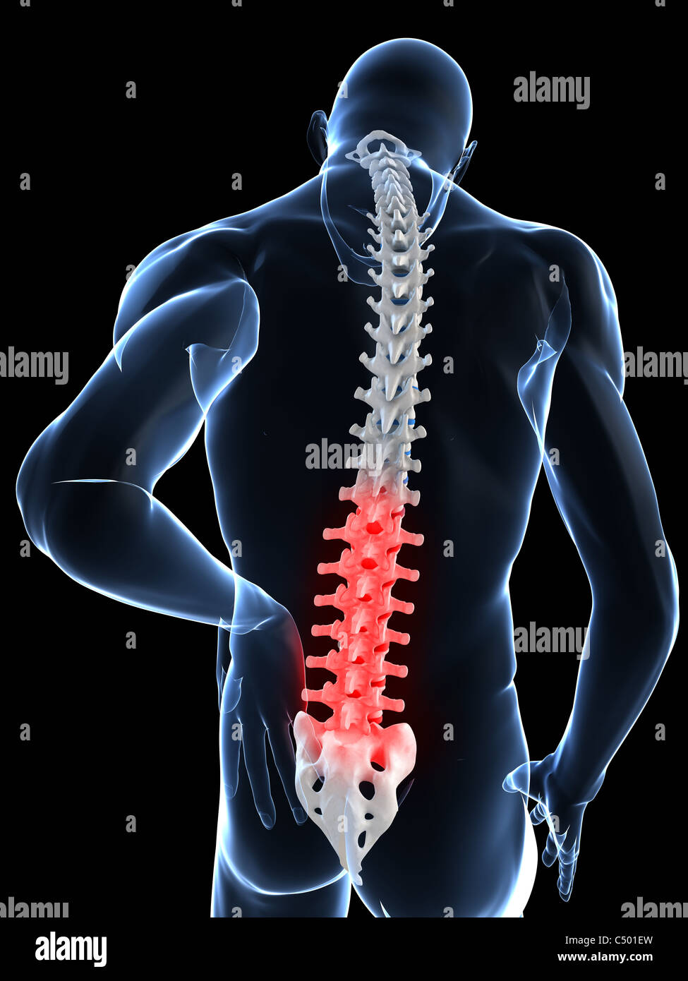 human with painful spine Stock Photo - Alamy