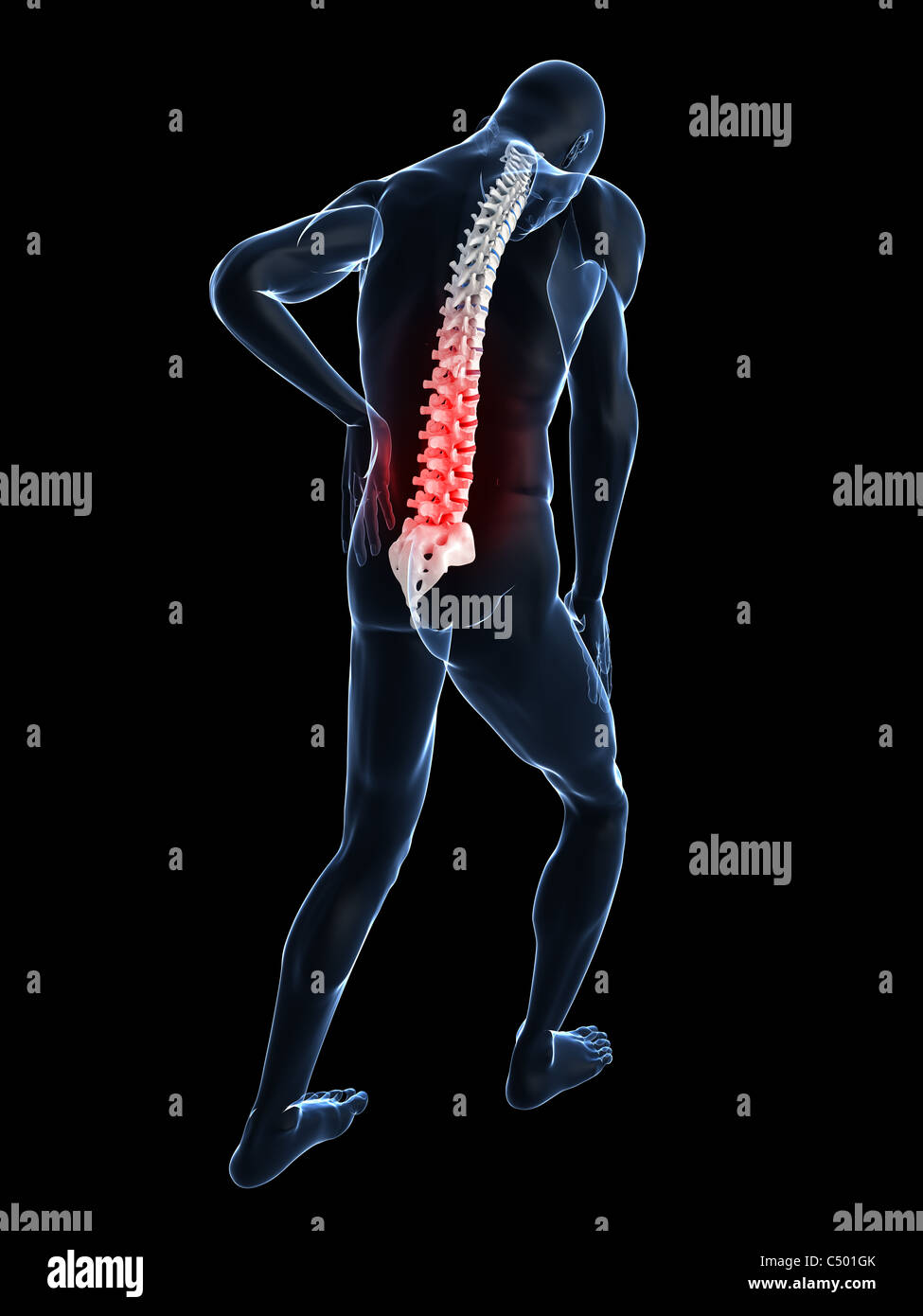 human with painful spine Stock Photo - Alamy