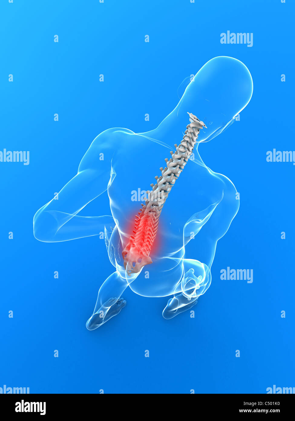 human with painful spine Stock Photo - Alamy