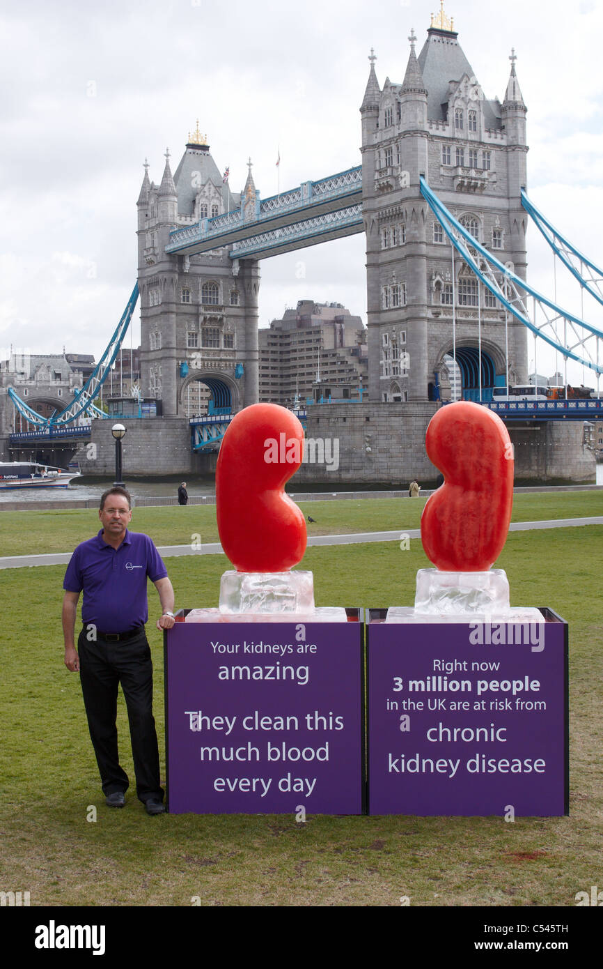 Kidney research uk hi-res stock photography and images - Alamy