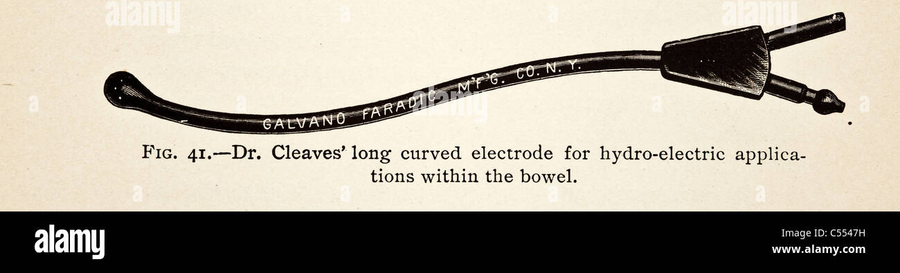 Antique medical illustration of a colon scope Stock Photo - Alamy