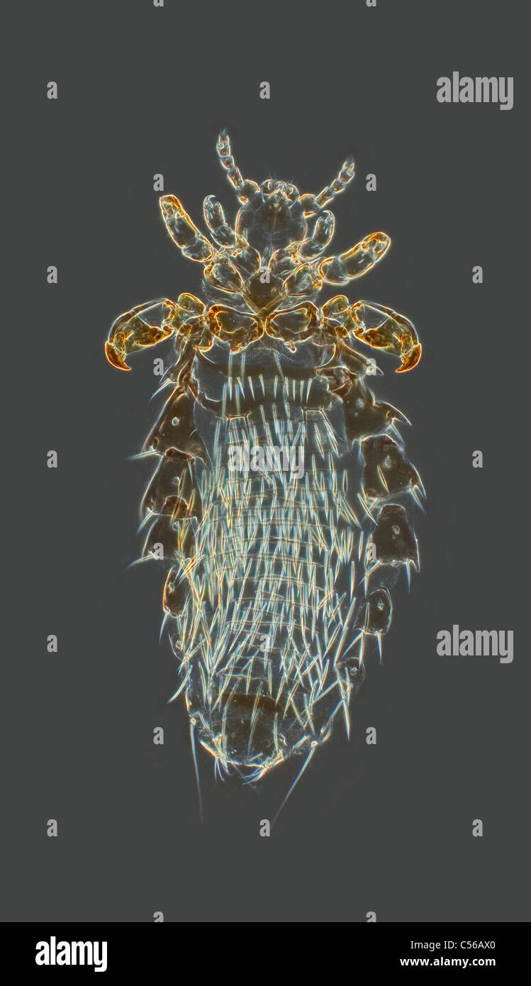 Darkfield photomicrograph of Cotton rat louse, female, Hophleura ...