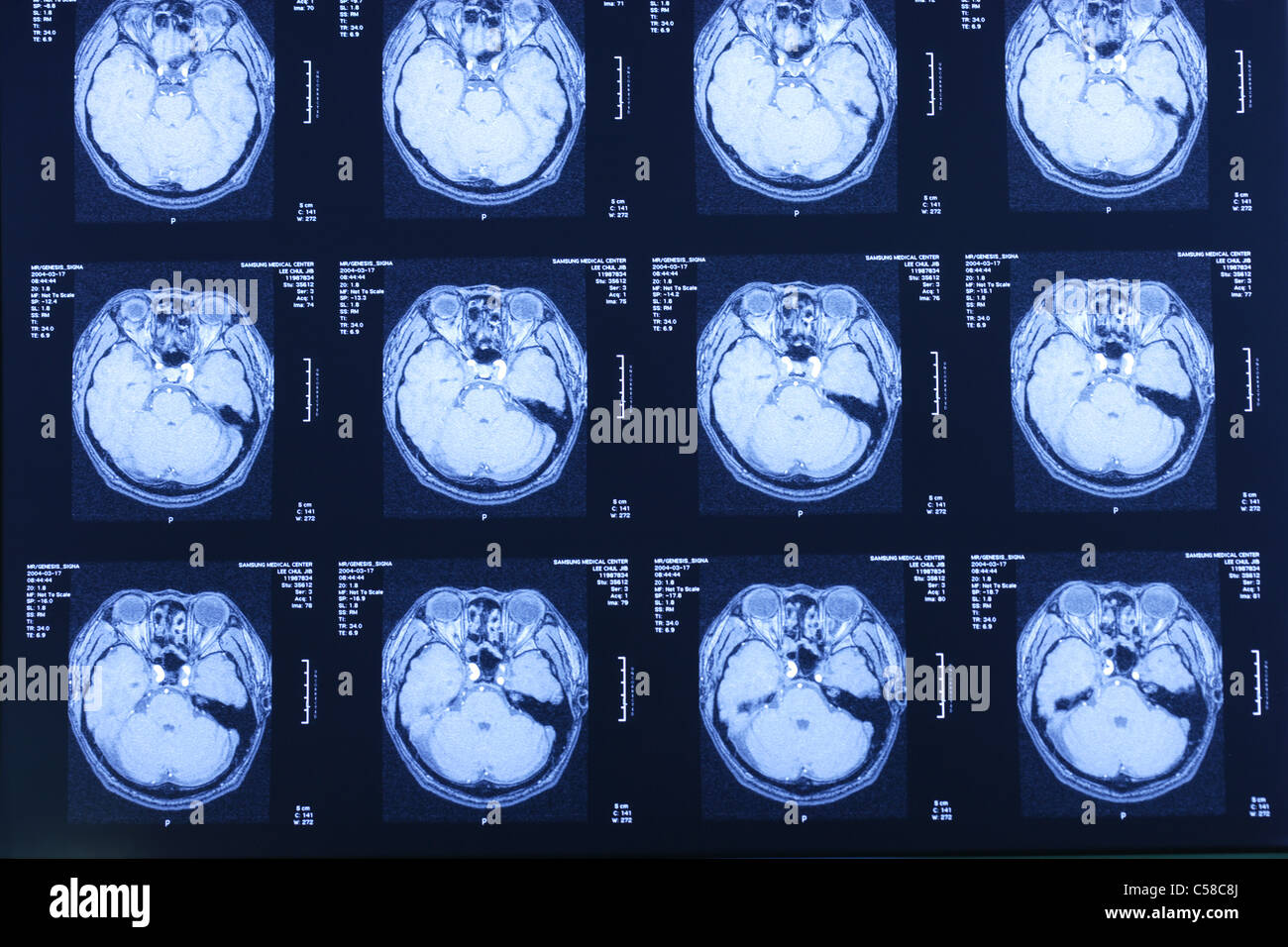 CT Scan Showing Cross-Section of Human Head Stock Photo - Alamy