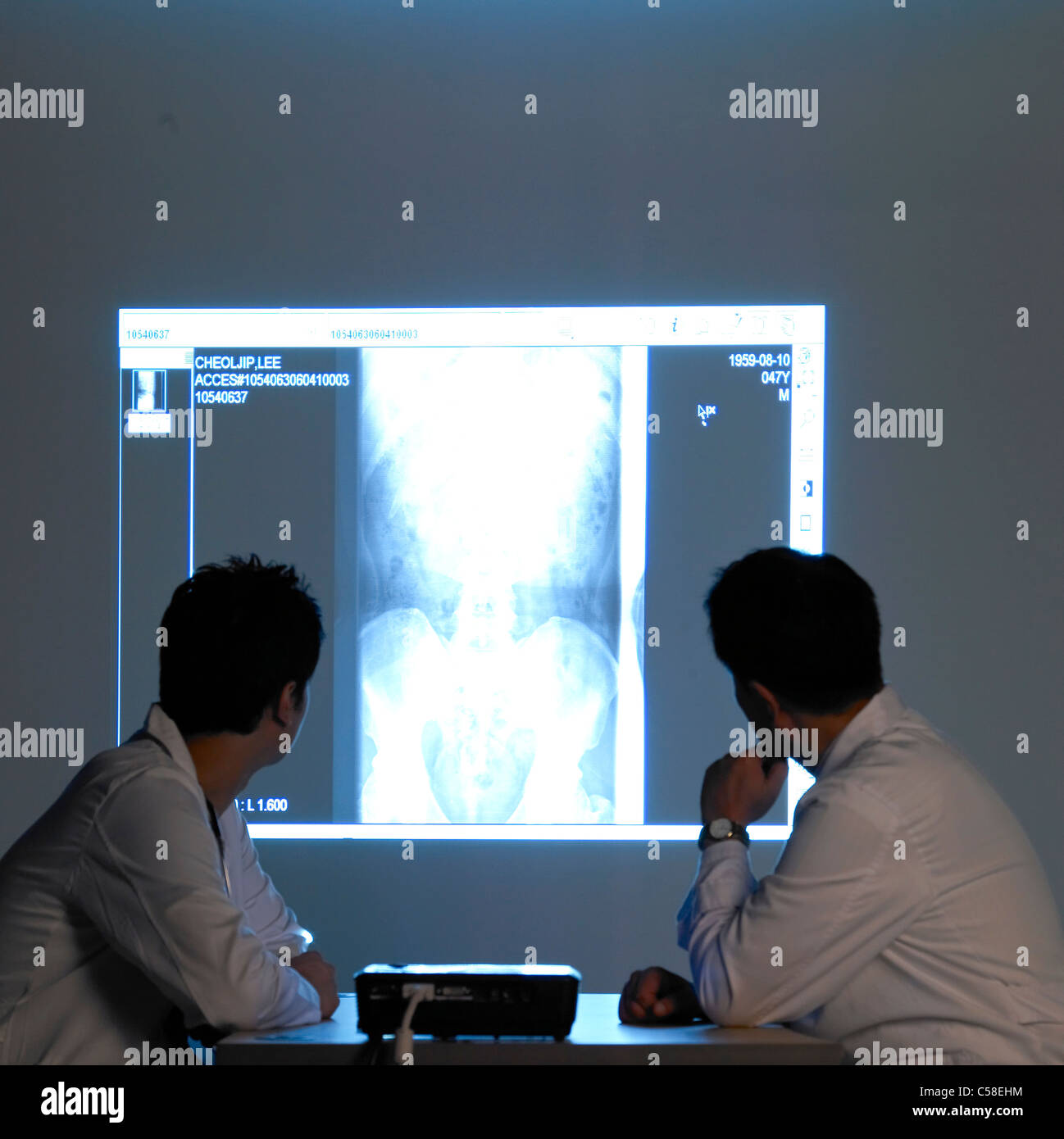 Spinal radiograph hi-res stock photography and images - Alamy