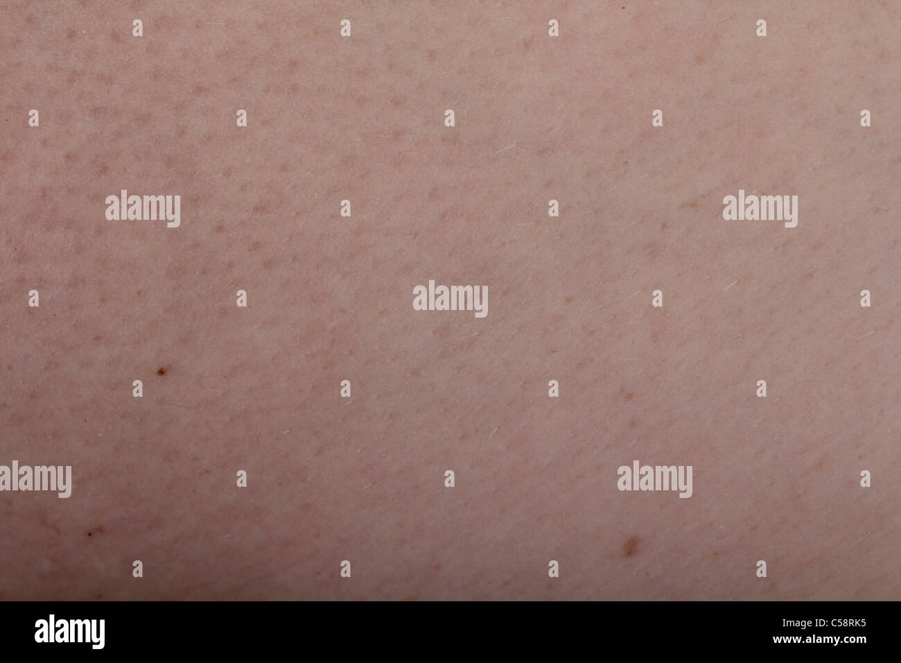 white human skin Stock Photo - Alamy