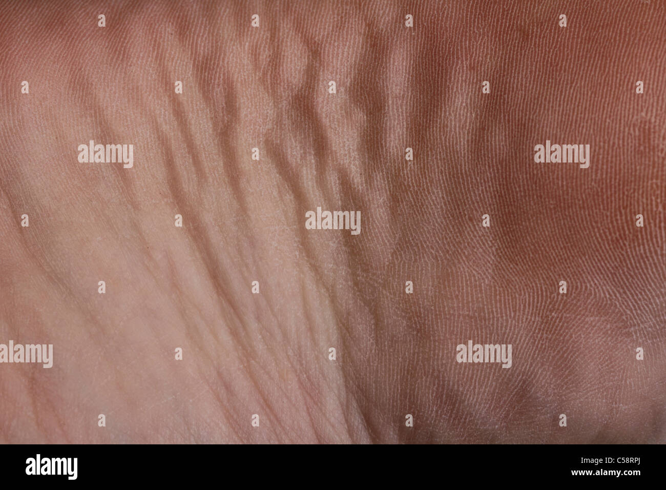 wrinkled human skin Stock Photo - Alamy