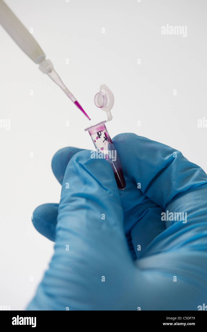 Wednesday 6th July 2011 Lab technician using a pipette at the Leeds ...
