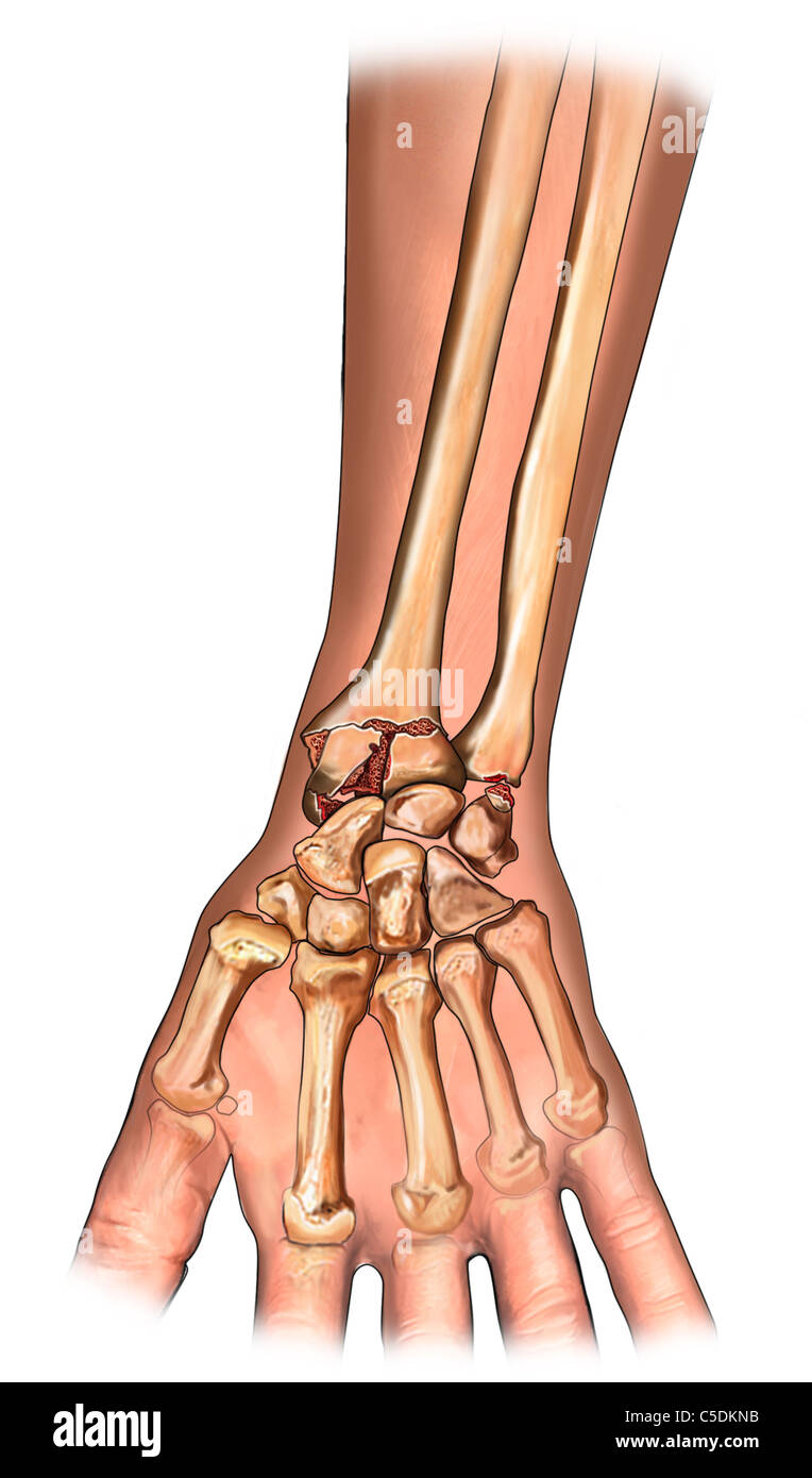 Dorsal wrist hi-res stock photography and images - Alamy