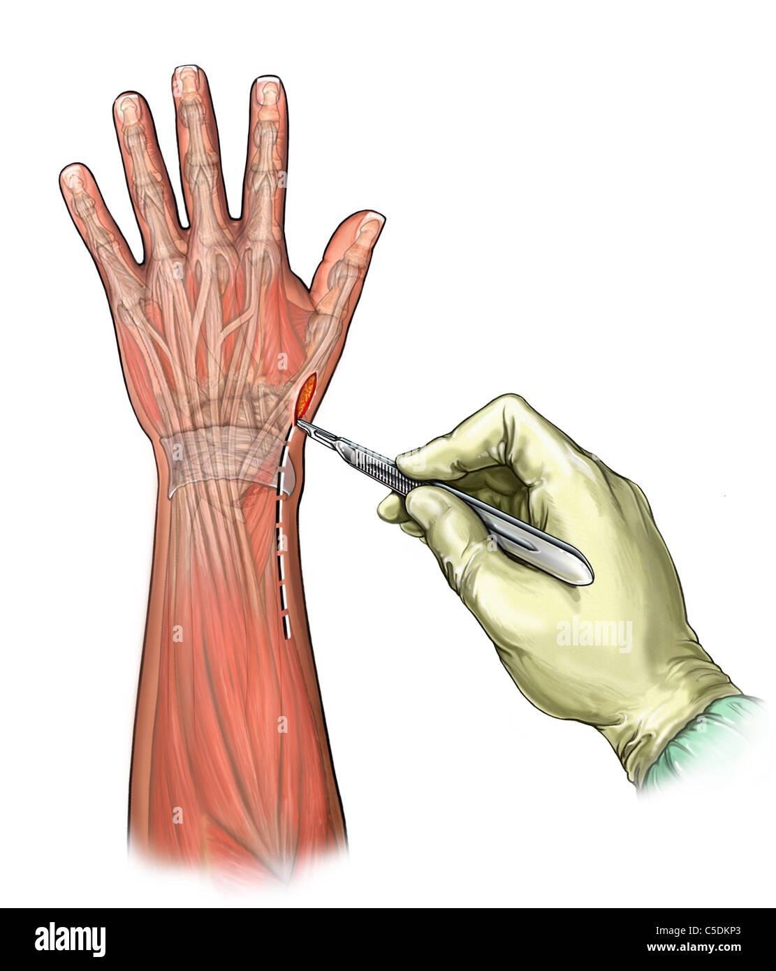 Wrist hand hi-res stock photography and images - Alamy