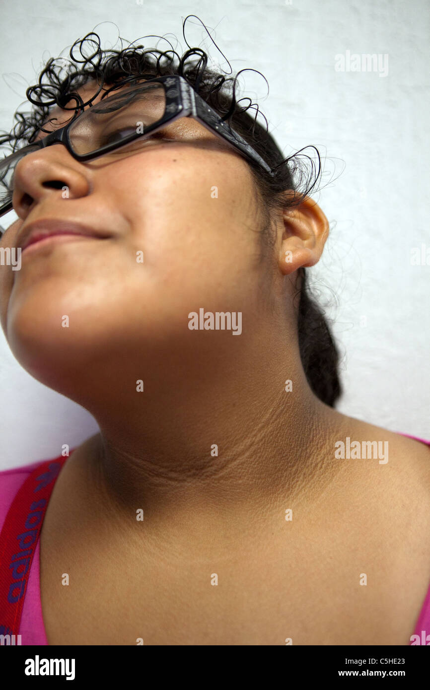 Hyperpigmentation High Resolution Stock Photography and Images - Alamy