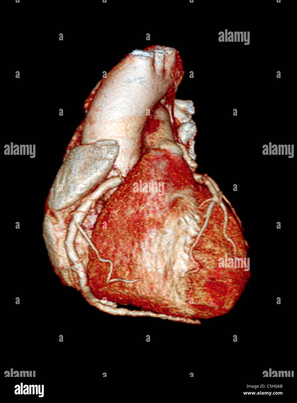 3d ct scan human heart hi-res stock photography and images - Alamy