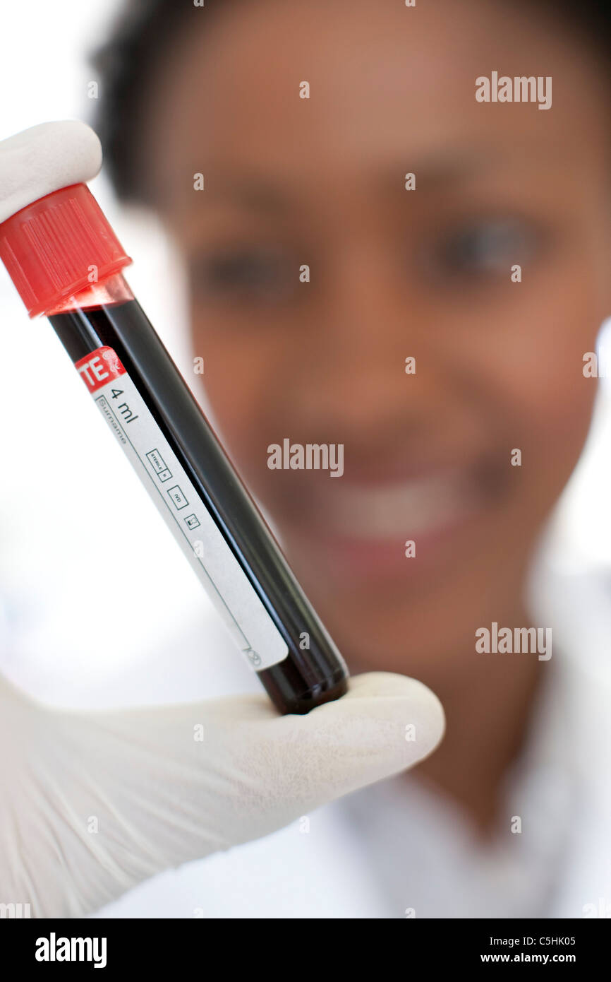 Blood sample hi-res stock photography and images - Alamy