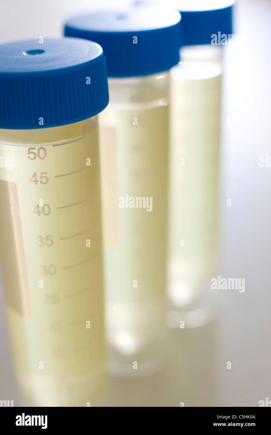 Sample frames hi-res stock photography and images - Alamy