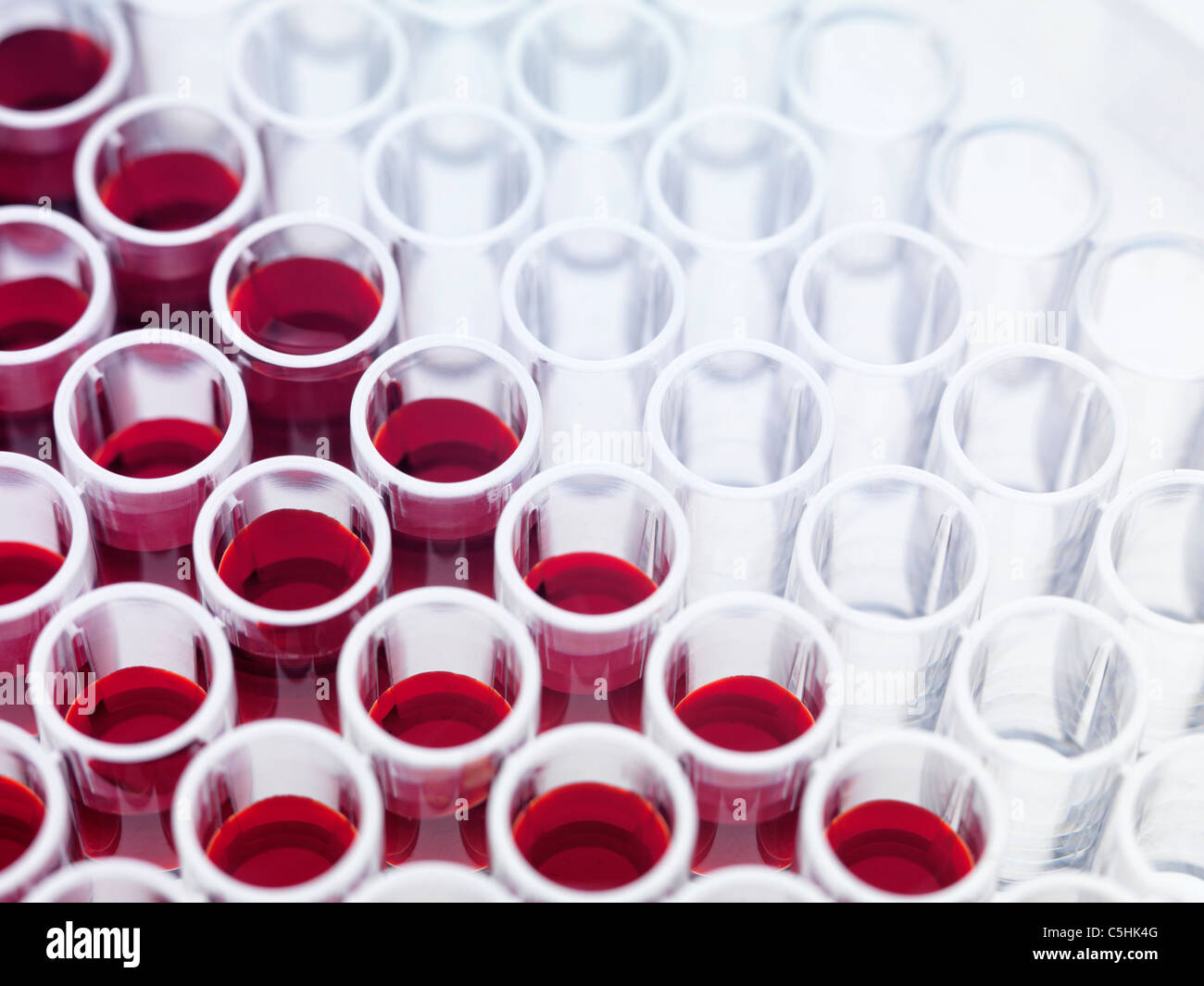 Blood cup of sample samples hi-res stock photography and images - Alamy