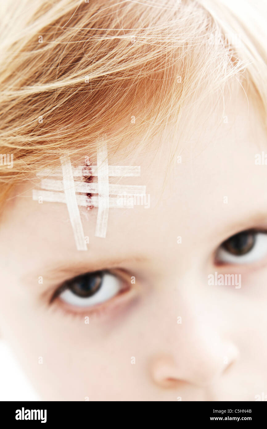 Steristrip hi-res stock photography and images - Alamy