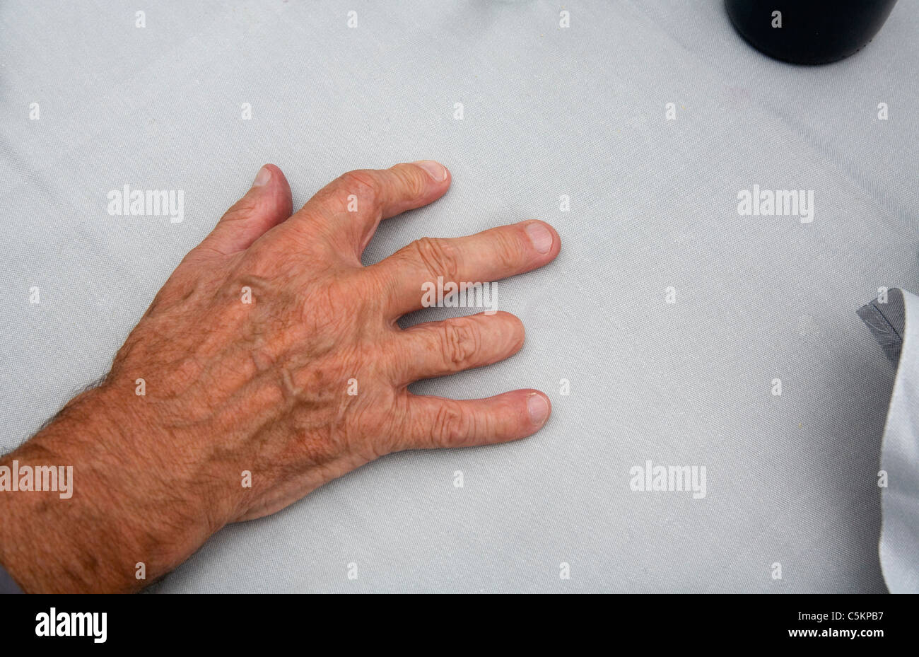A man's right hand on a linen tablecloth close-up, tip of third finger ...