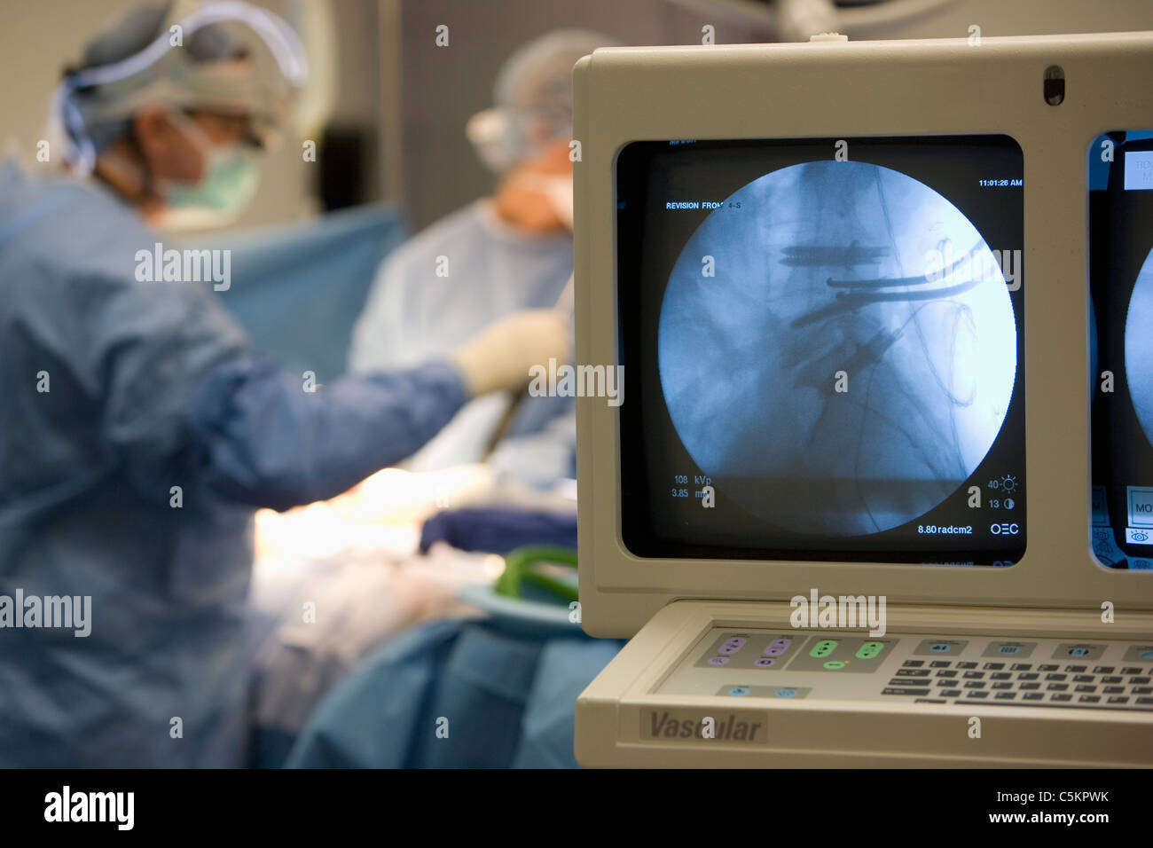 Orthopedic procedure hi-res stock photography and images - Alamy