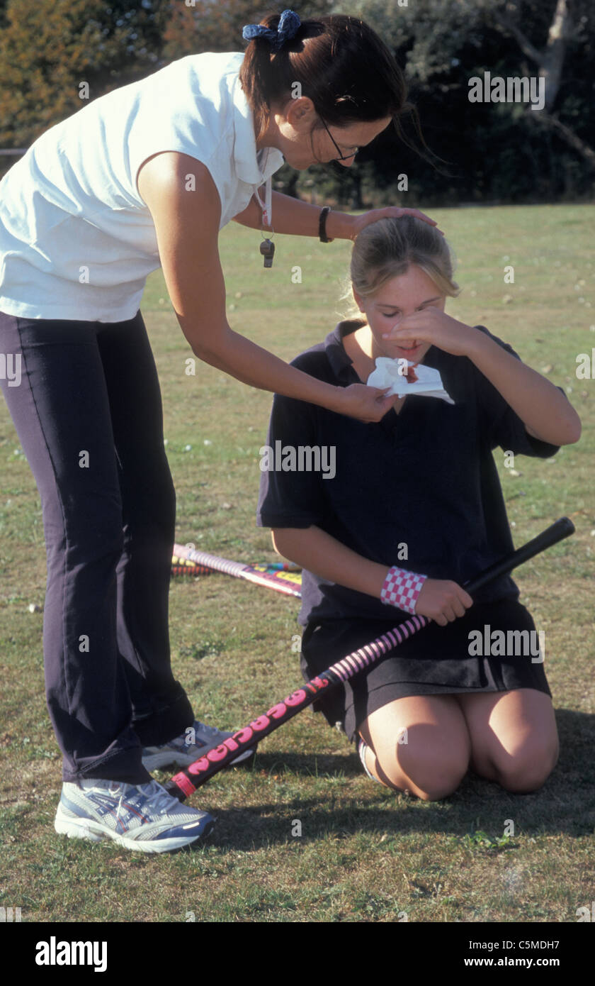 Girl nose bleed hi-res stock photography and images - Alamy