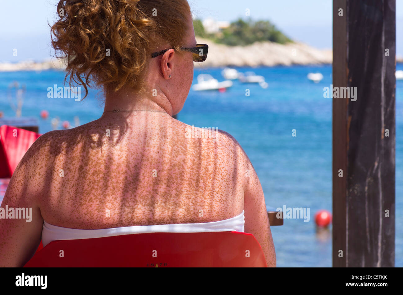 Sunburn risks hi-res stock photography and images - Alamy