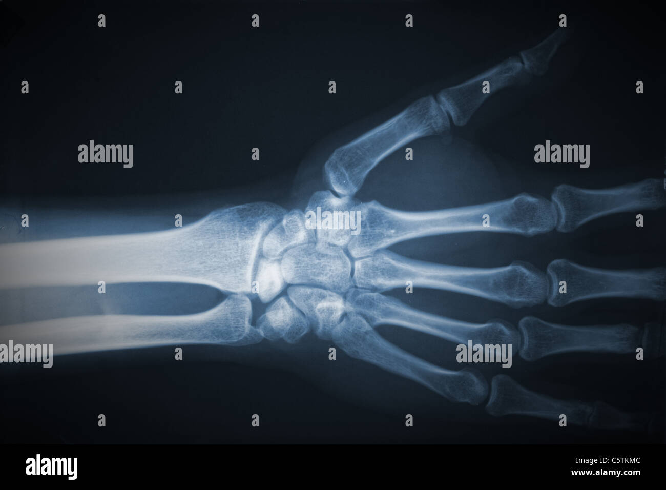 Hand anatomy hi-res stock photography and images - Alamy