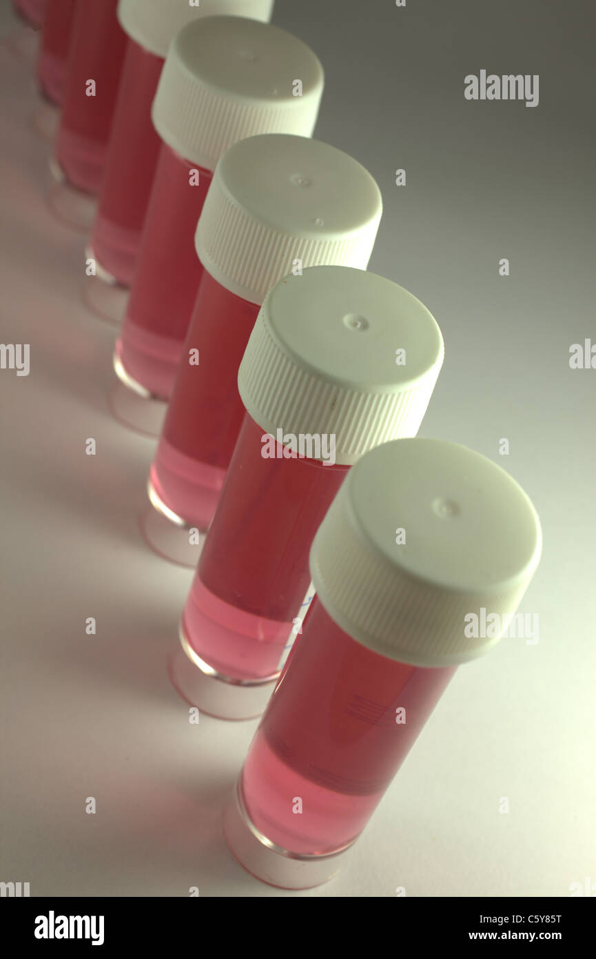 bodily fluids awaiting testing and analysis Stock Photo - Alamy