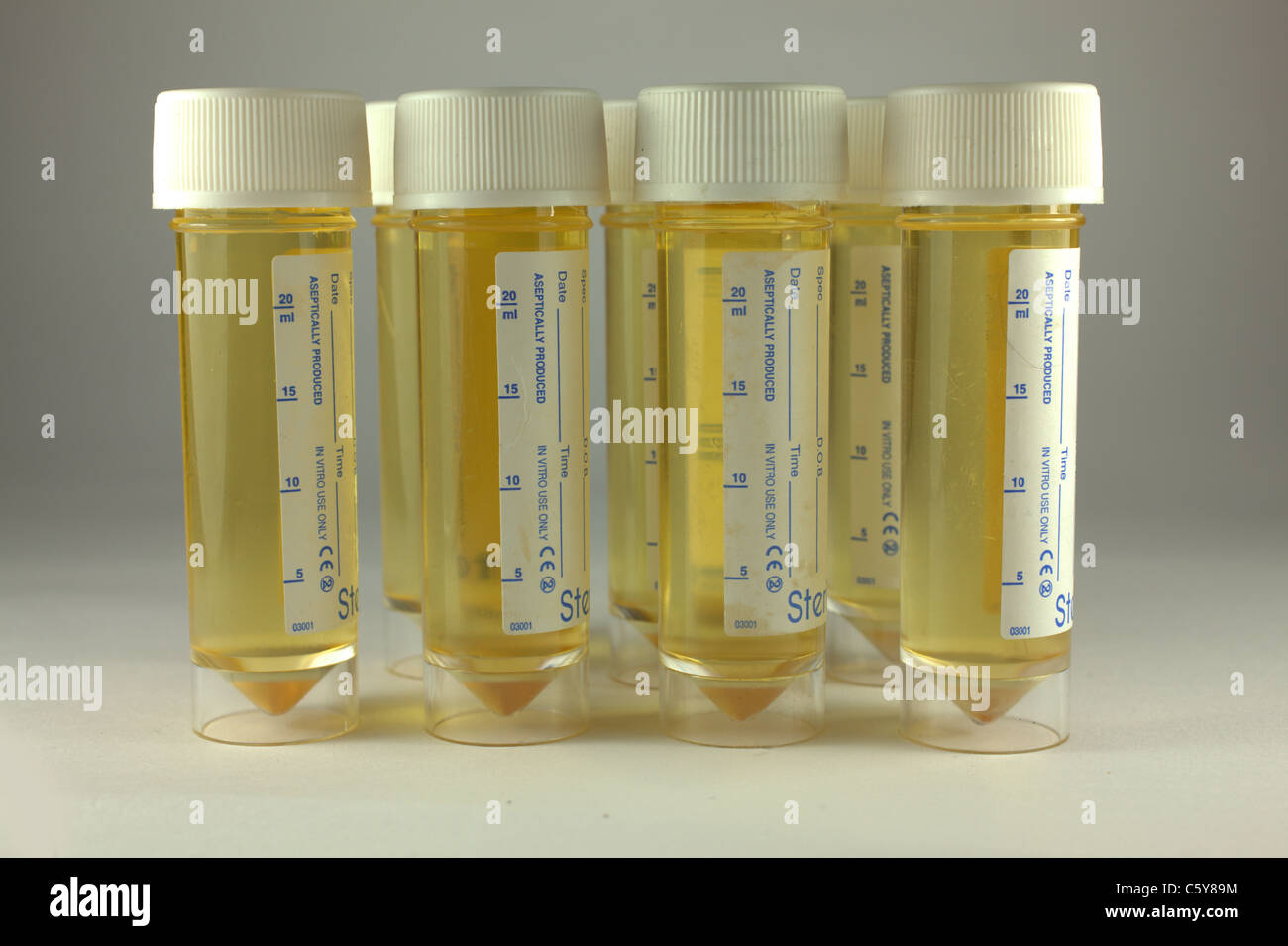 Urine specimen bottles Stock Photo - Alamy