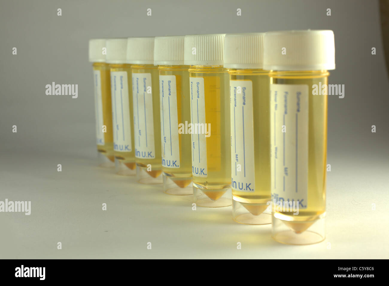 Urine specimen bottles Stock Photo - Alamy