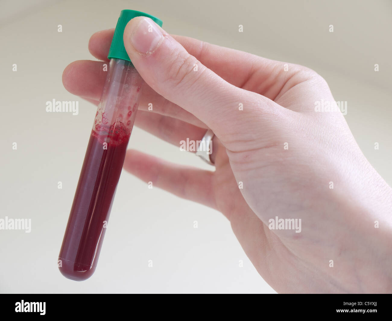 Blood collecting tube with green cap filled with blood held between ...