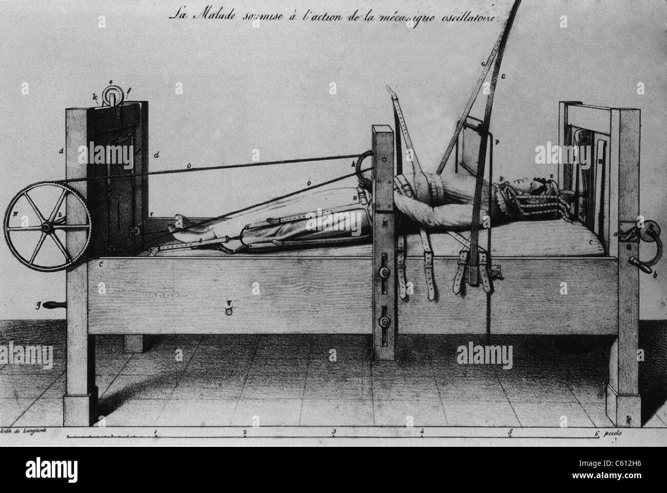 Female patient strapped into an orthopedic bed, with braces and cranks ...