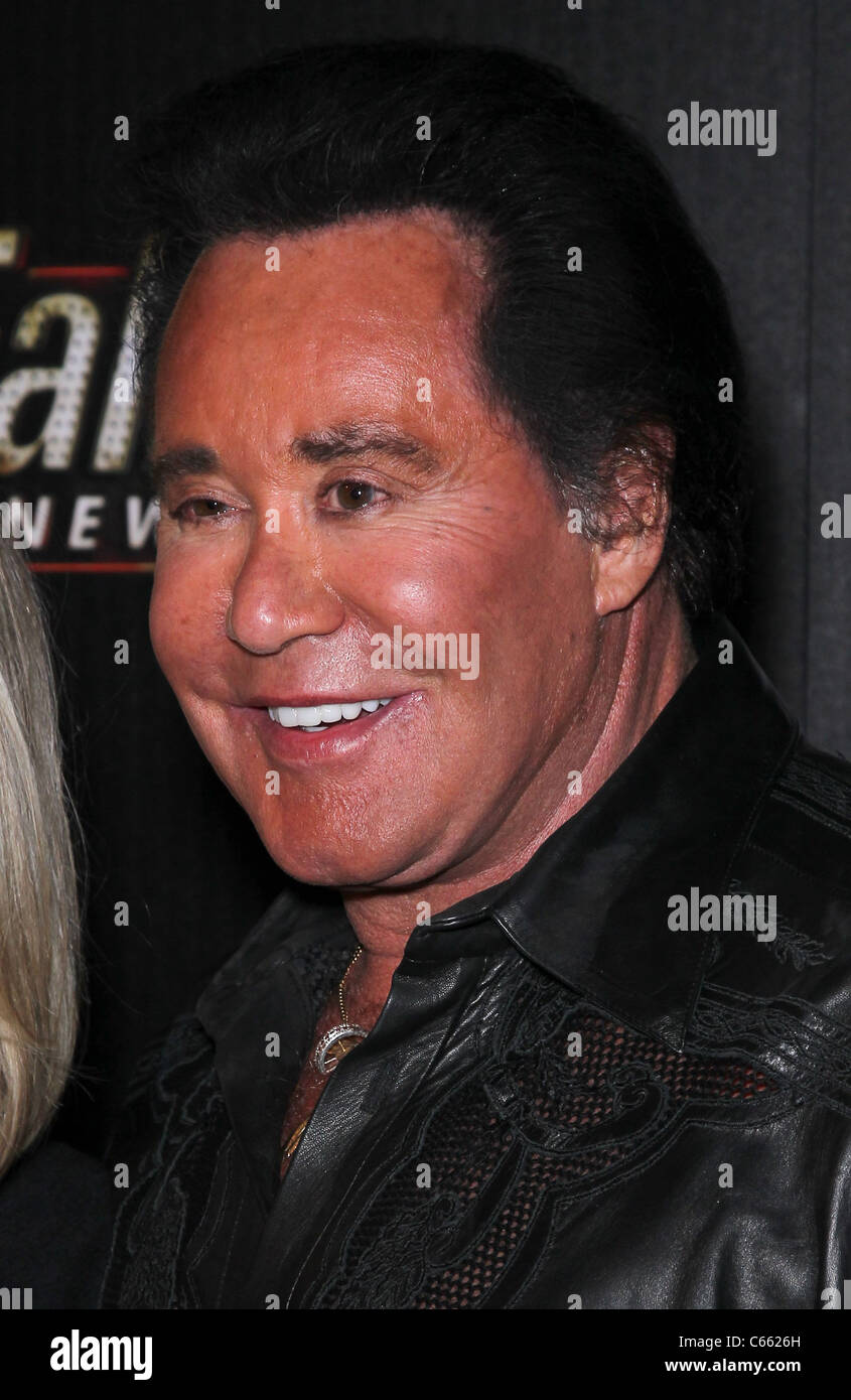 Wayne Newton Facelift