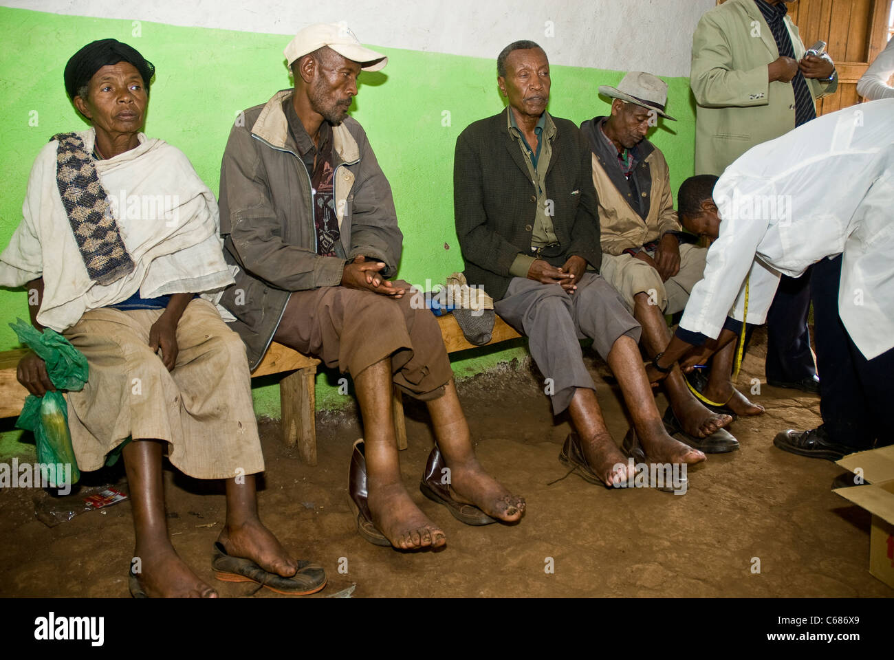 Patients with podoconiosis at the Koyo Mossy Foot Outreach Site in Sodo ...
