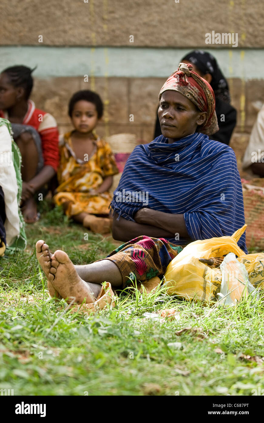 Patient with podoconiosis at the Mossy Foot Outreach Clinic in Sodo ...
