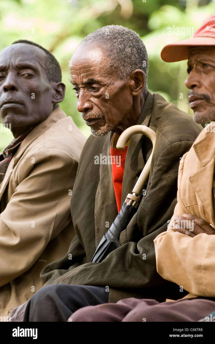 Patient with podoconiosis at the Mossy Foot Outreach Clinic in Sodo ...