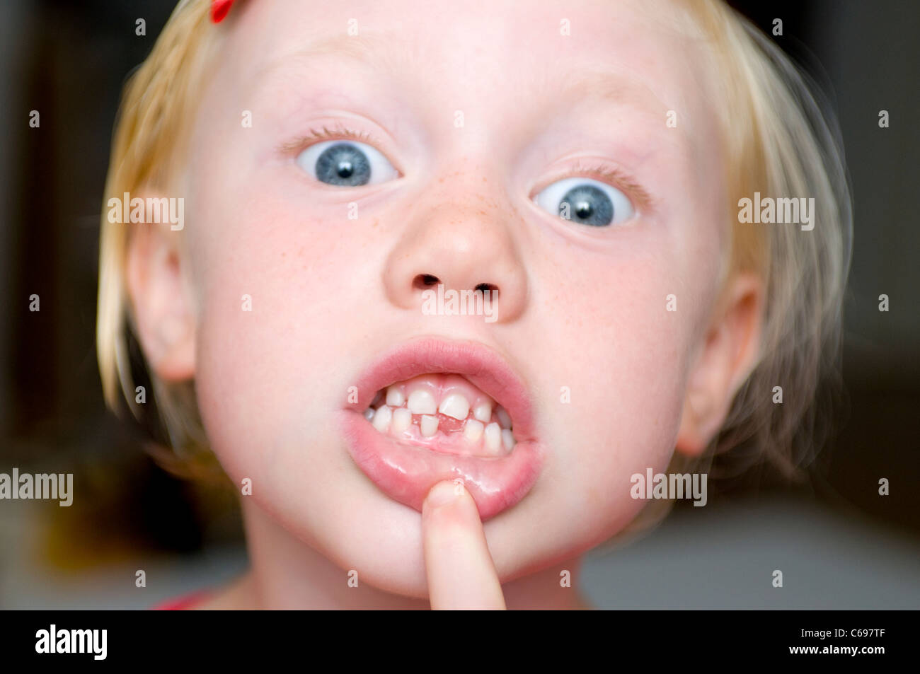 Young female child with first tooth missing Stock Photo - Alamy