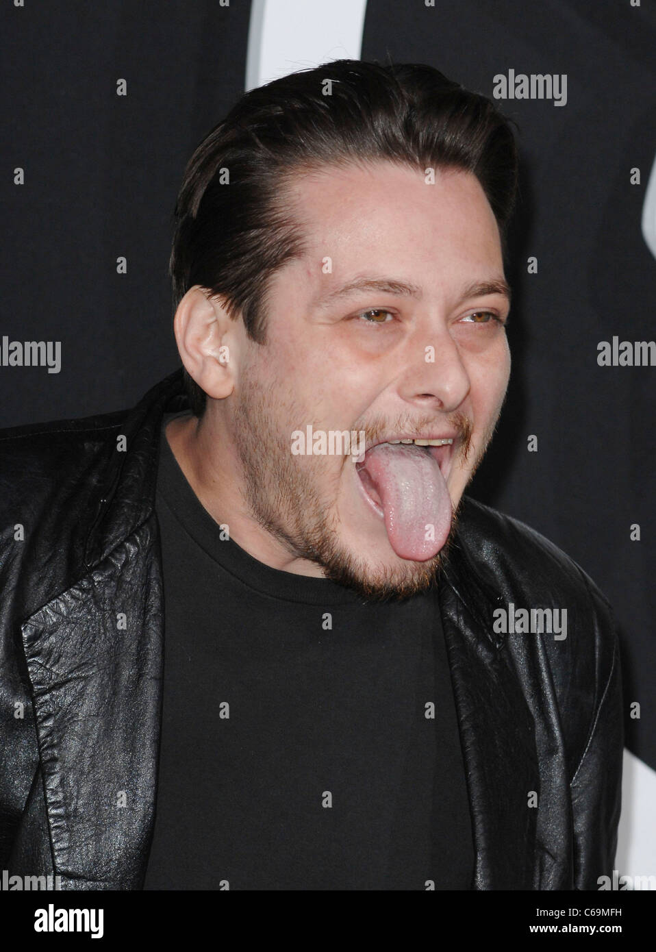 Edward Furlong Teeth Before And After