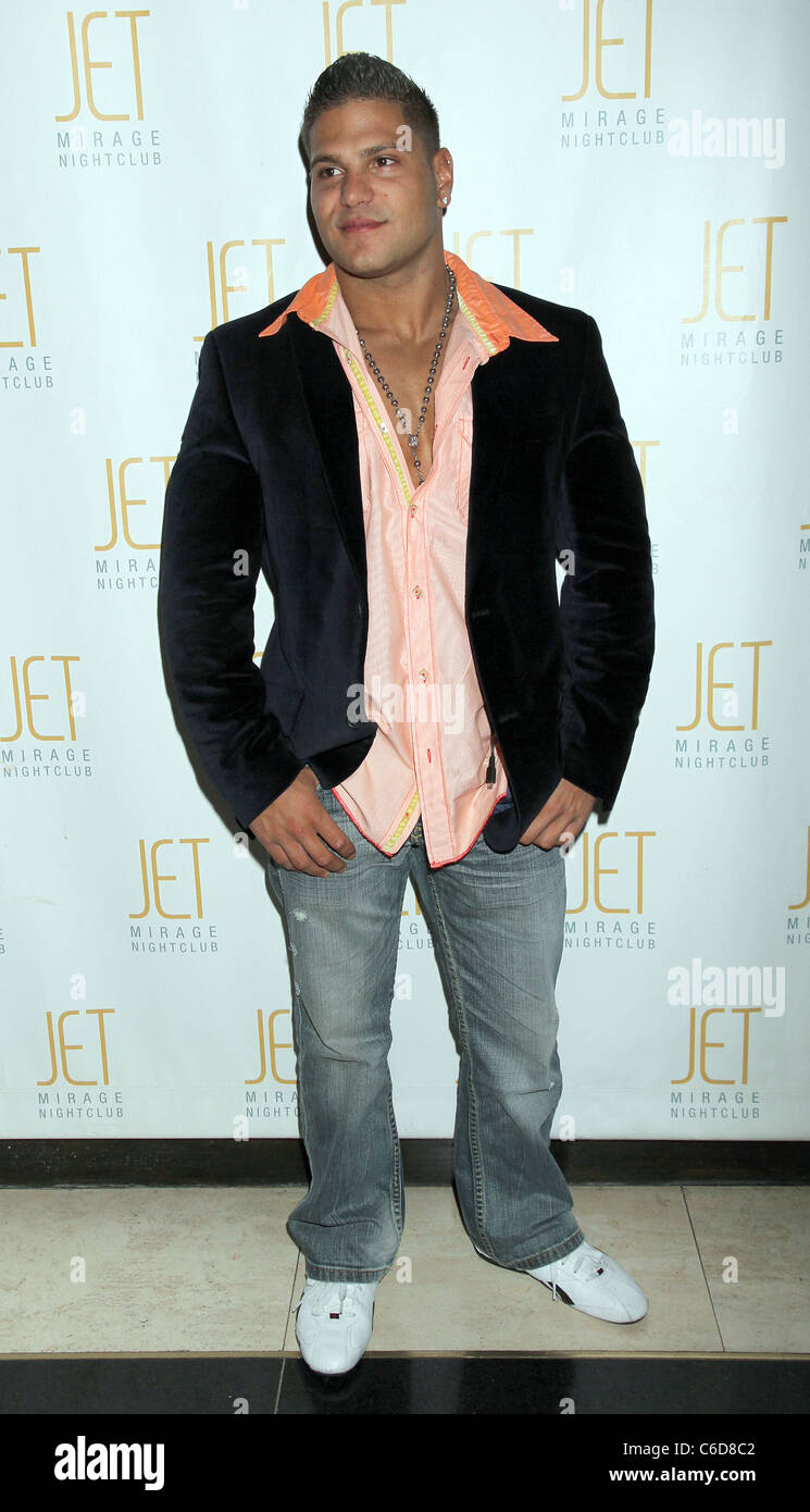 Ronnie Magro Veneers Before And After at Dakota Frith blog