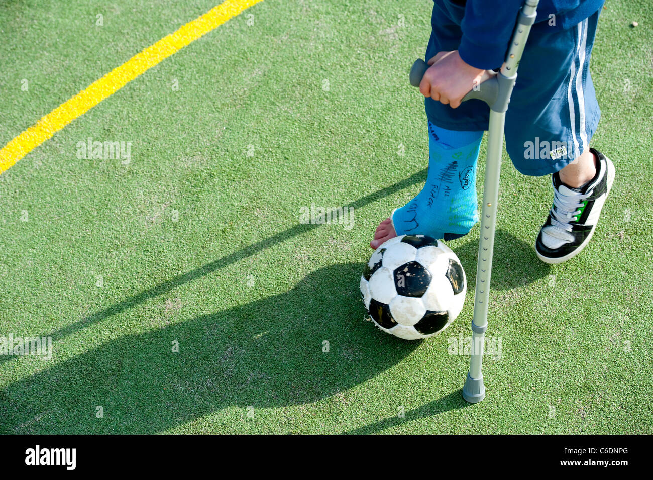 Broken leg boy hi-res stock photography and images - Alamy