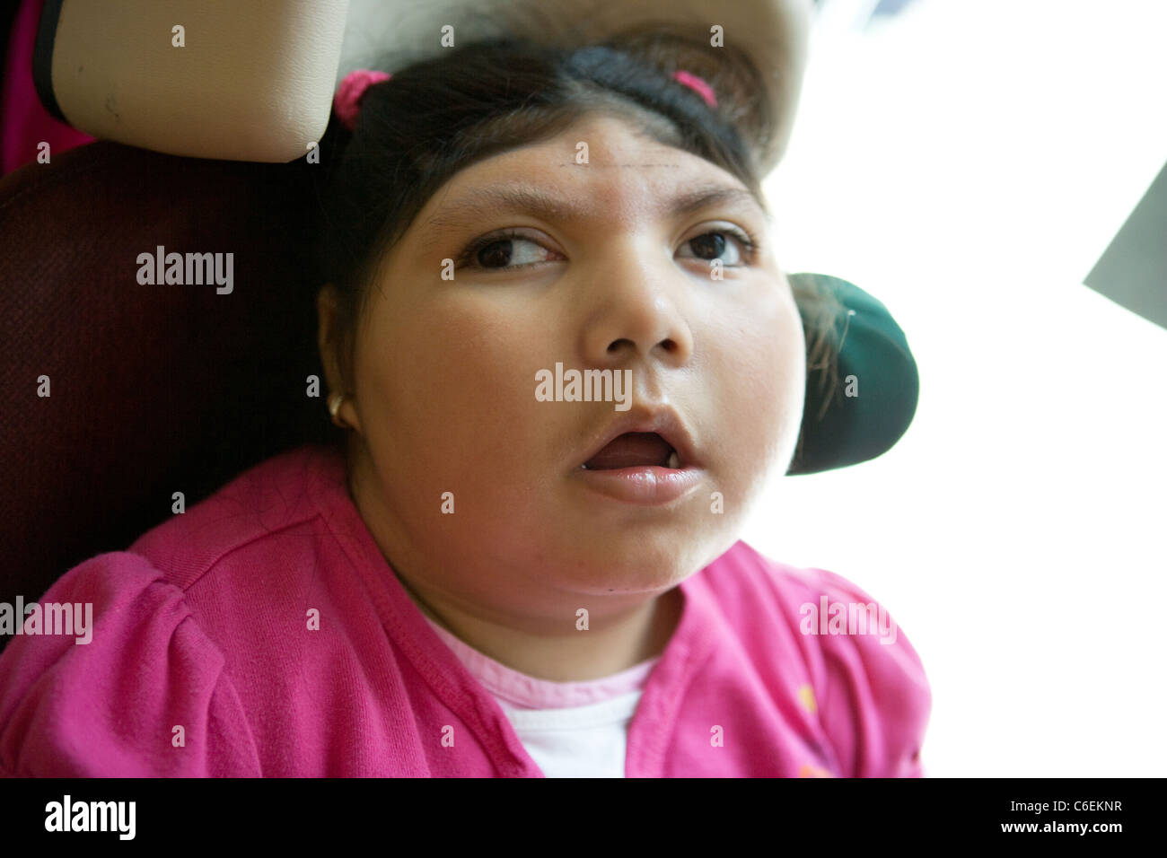 Deaf blind seven year old girl, portrait Stock Photo - Alamy