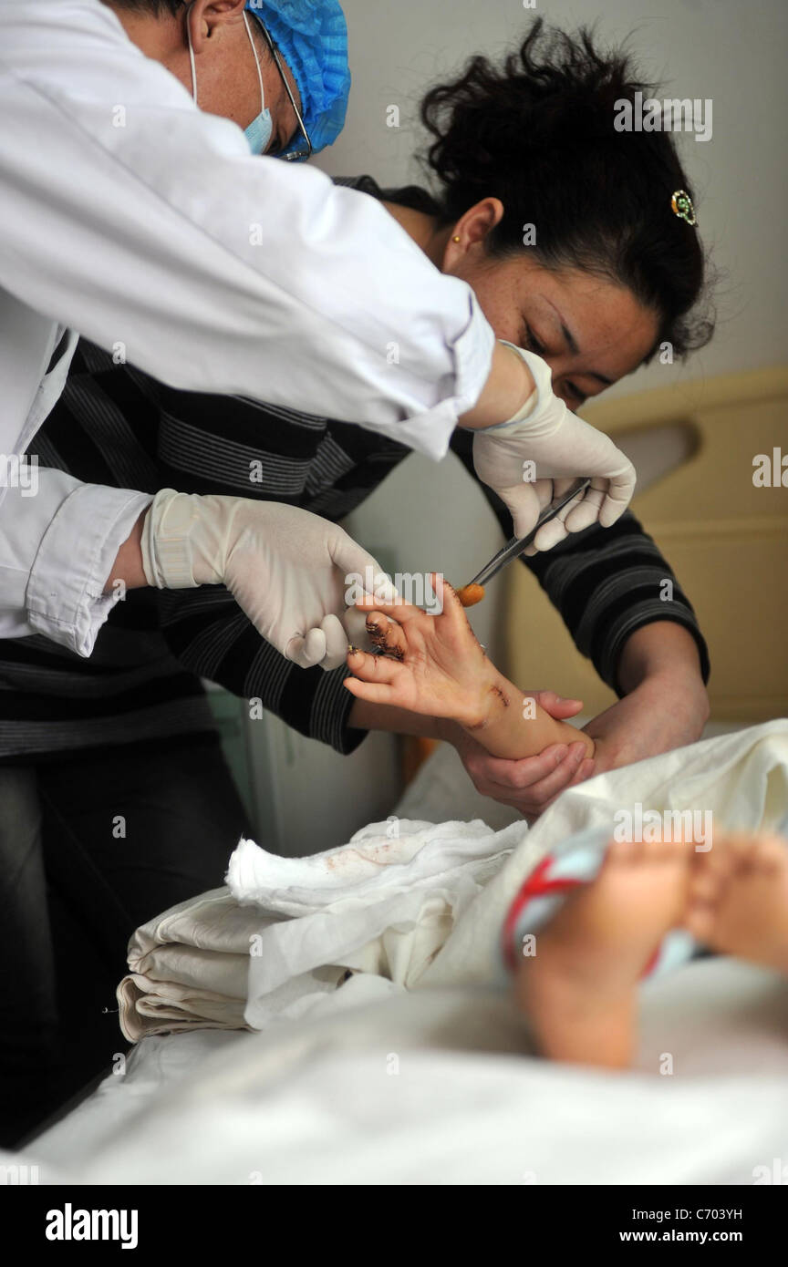 Counting toes hi-res stock photography and images - Alamy