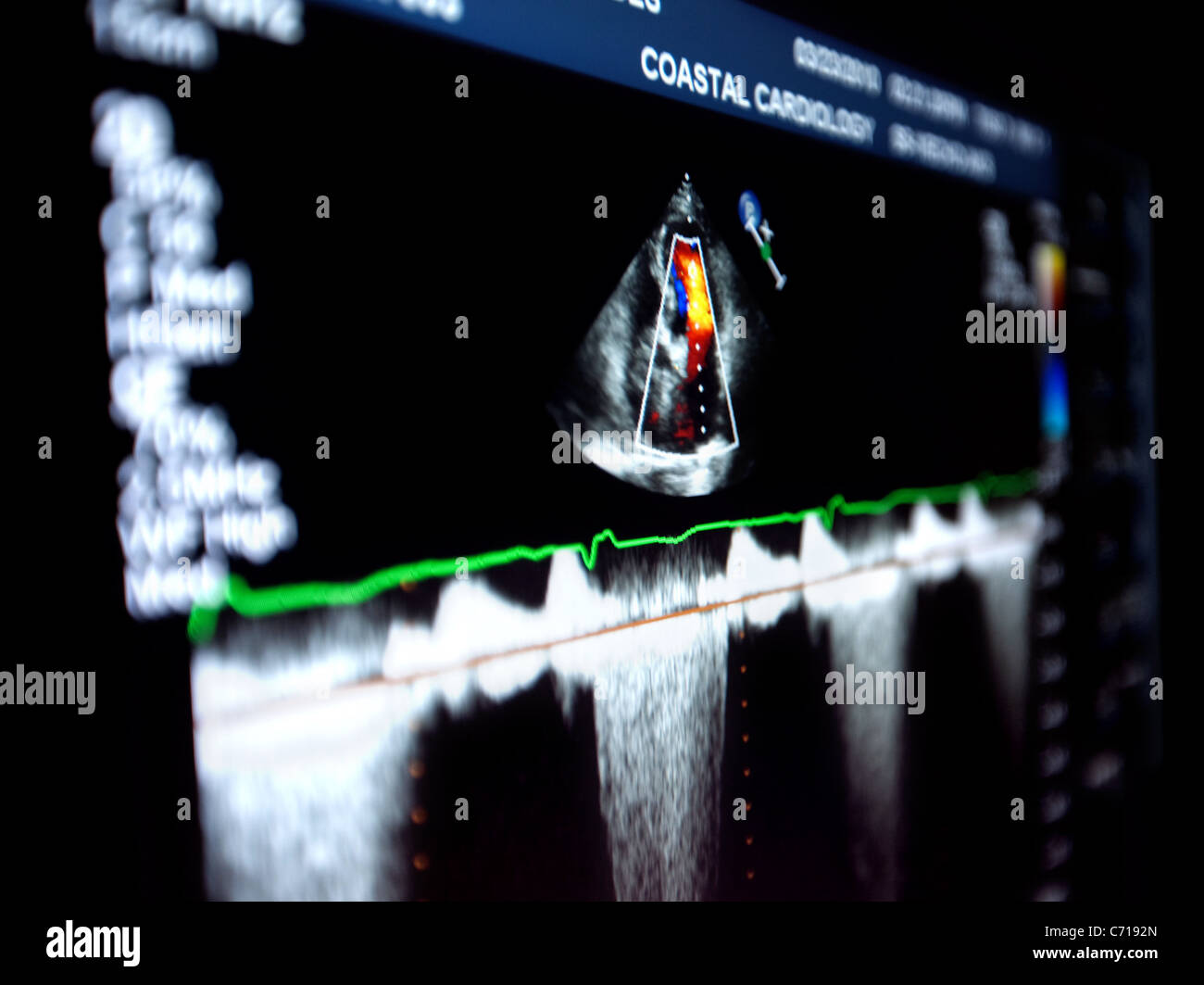 Detail of heart scan Stock Photo - Alamy