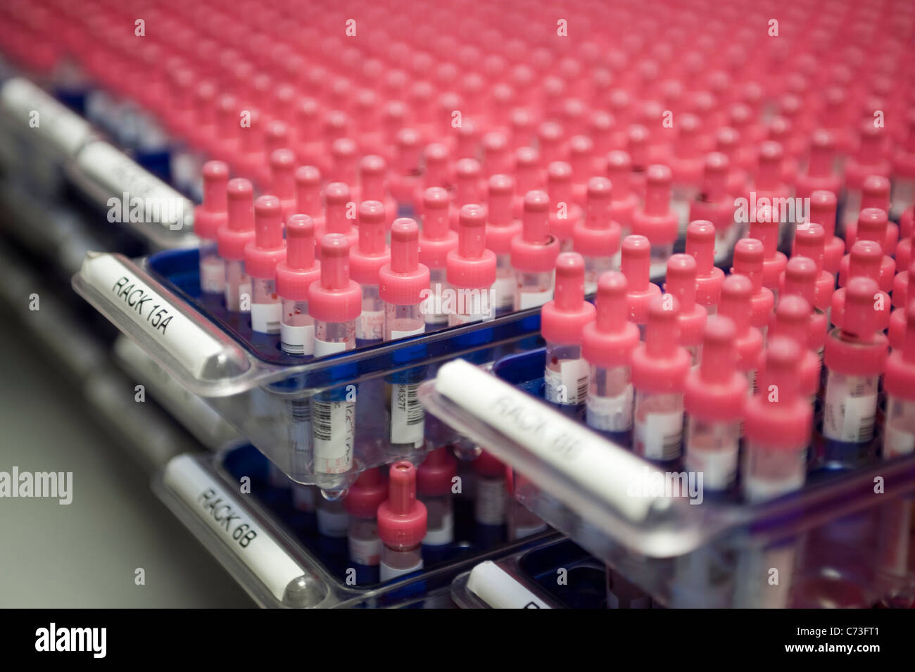 Blood samples being tested Stock Photo - Alamy