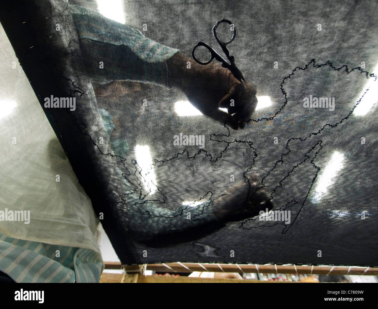 Knee with stitches hi-res stock photography and images - Alamy