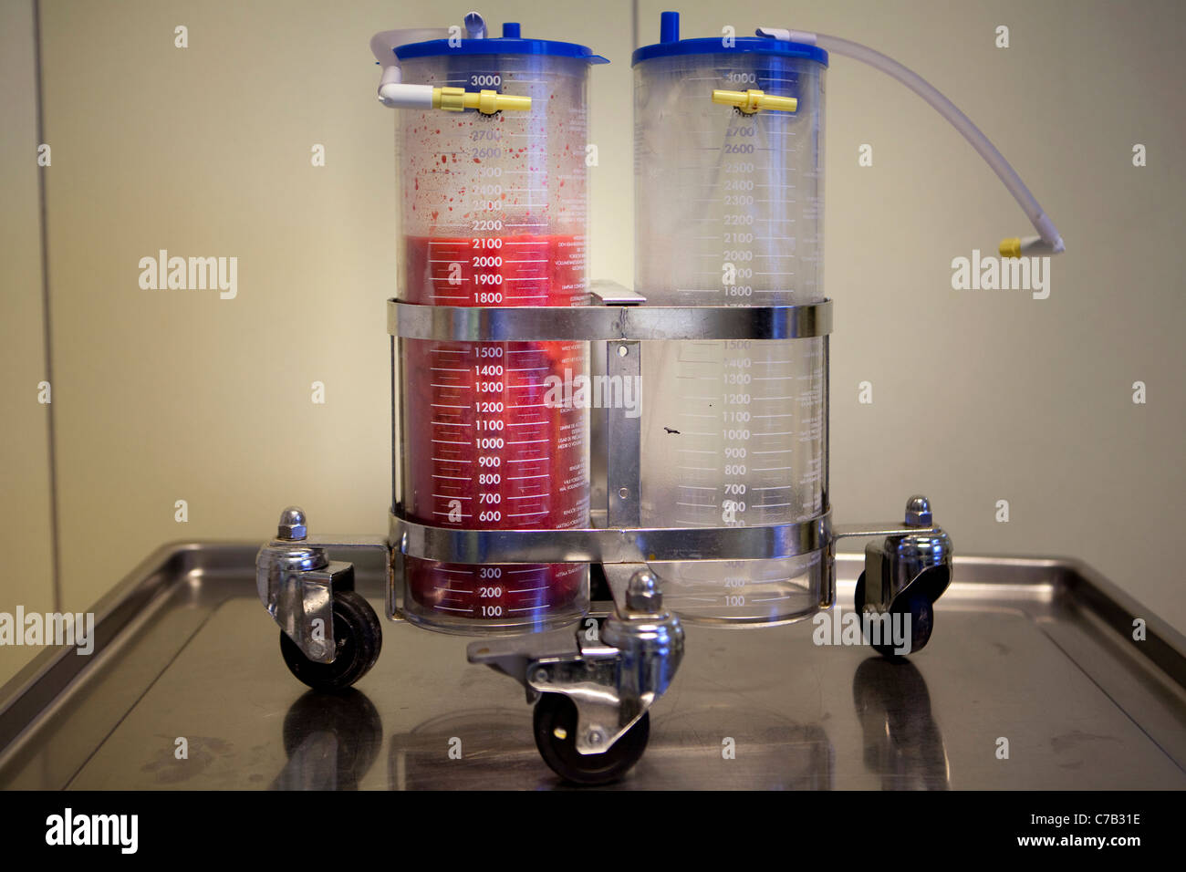 Fat Suction Woman High Resolution Stock Photography and Images - Alamy