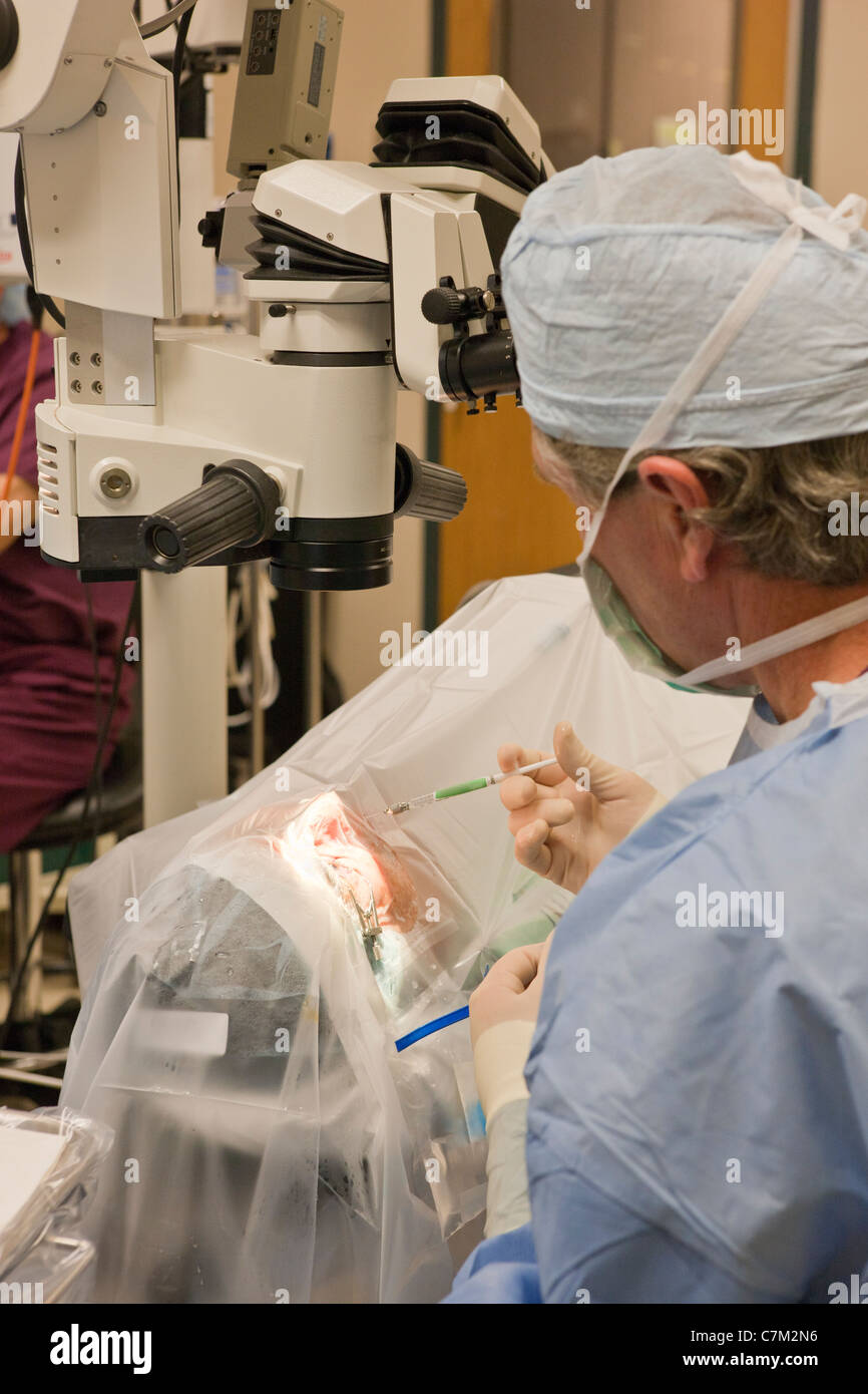 Ophthalmologist performing cataract surgery Stock Photo - Alamy