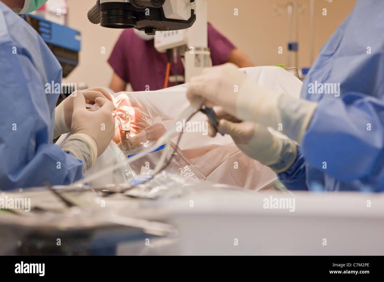 Ophthalmologist performing cataract surgery Stock Photo - Alamy