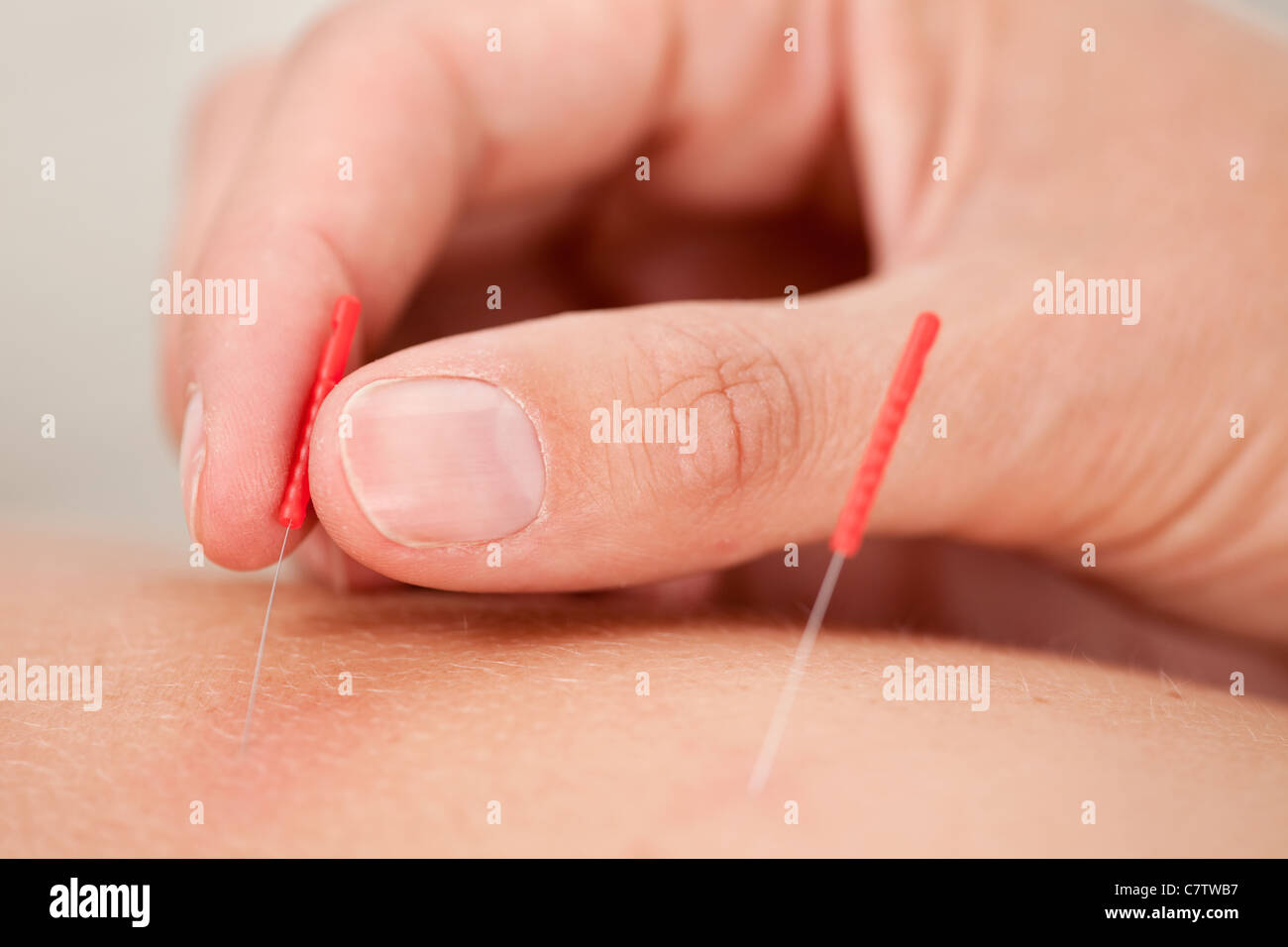 Filiform needle hi-res stock photography and images - Alamy